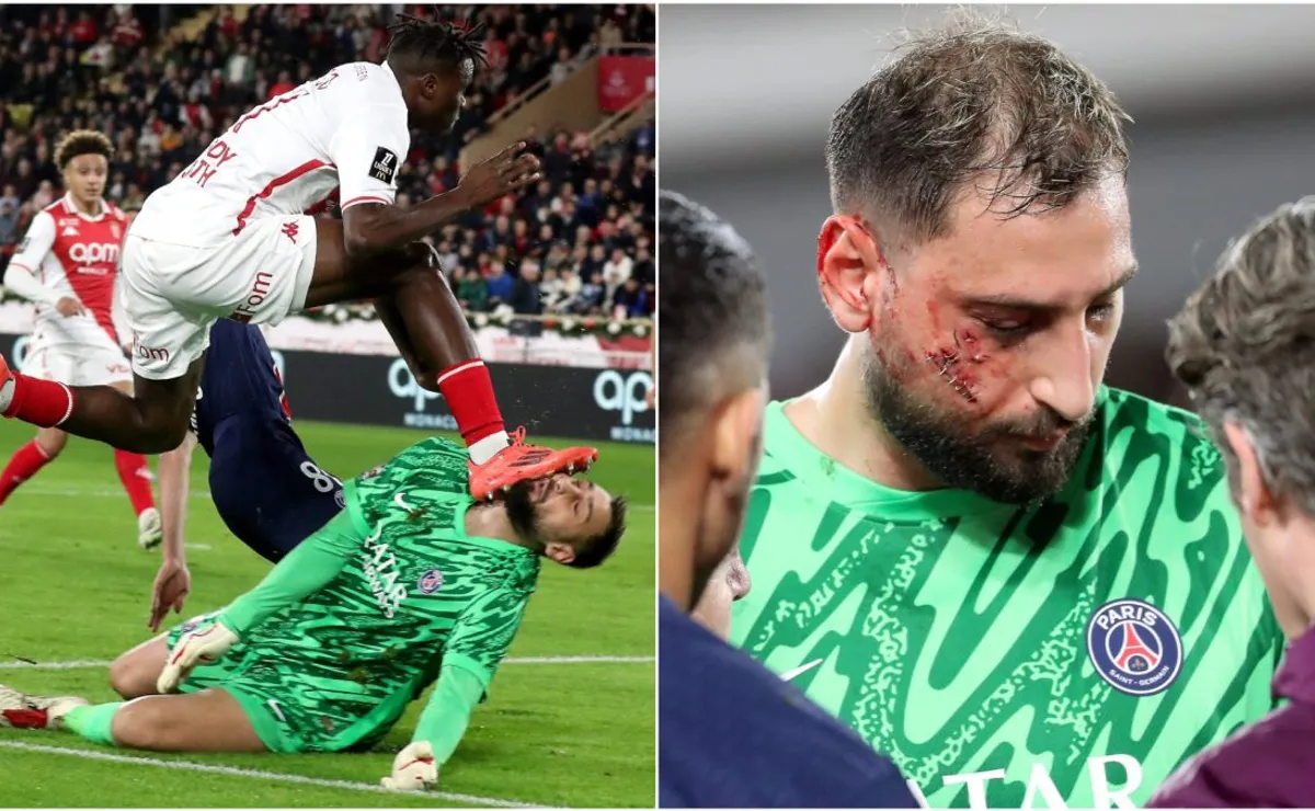 PSG’s Gianluigi Donnarumma suffers brutal face injury that sparks ...